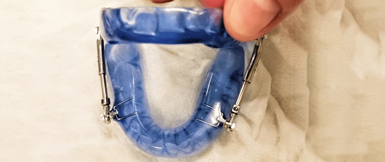 Sleep Apnea Oral Appliances in Mumbai | Tongue Tie India - Non-Invasive Treatment