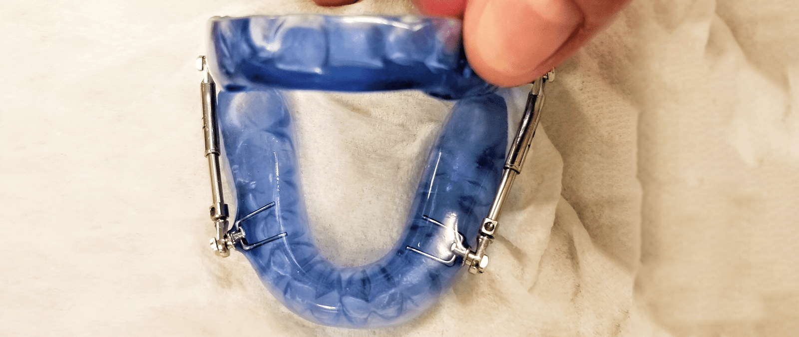 Sleep Apnea Oral Appliances in Mumbai | Tongue Tie India - Non-Invasive ...